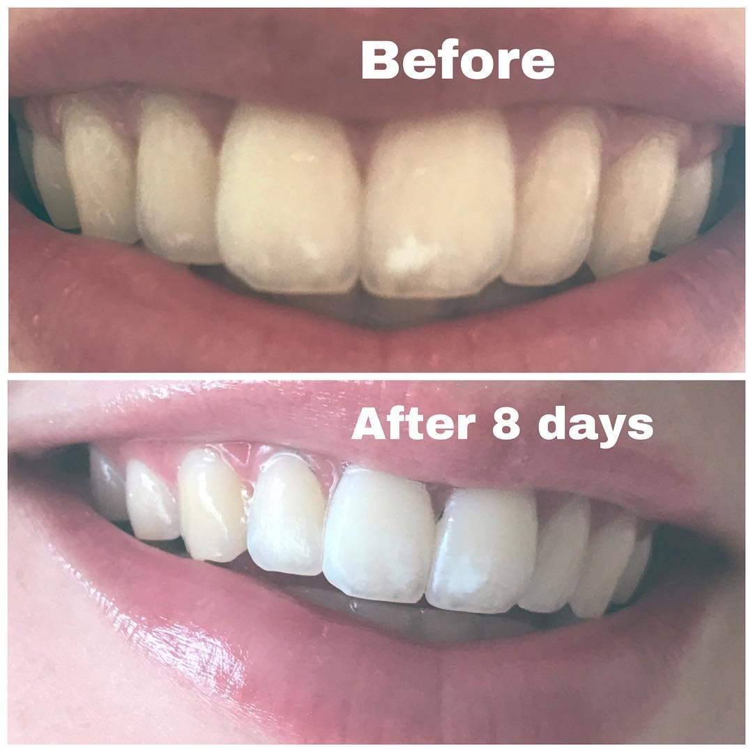 Natural Day & Night Toothpaste Duo | Organic Dental Care | Coco Clean